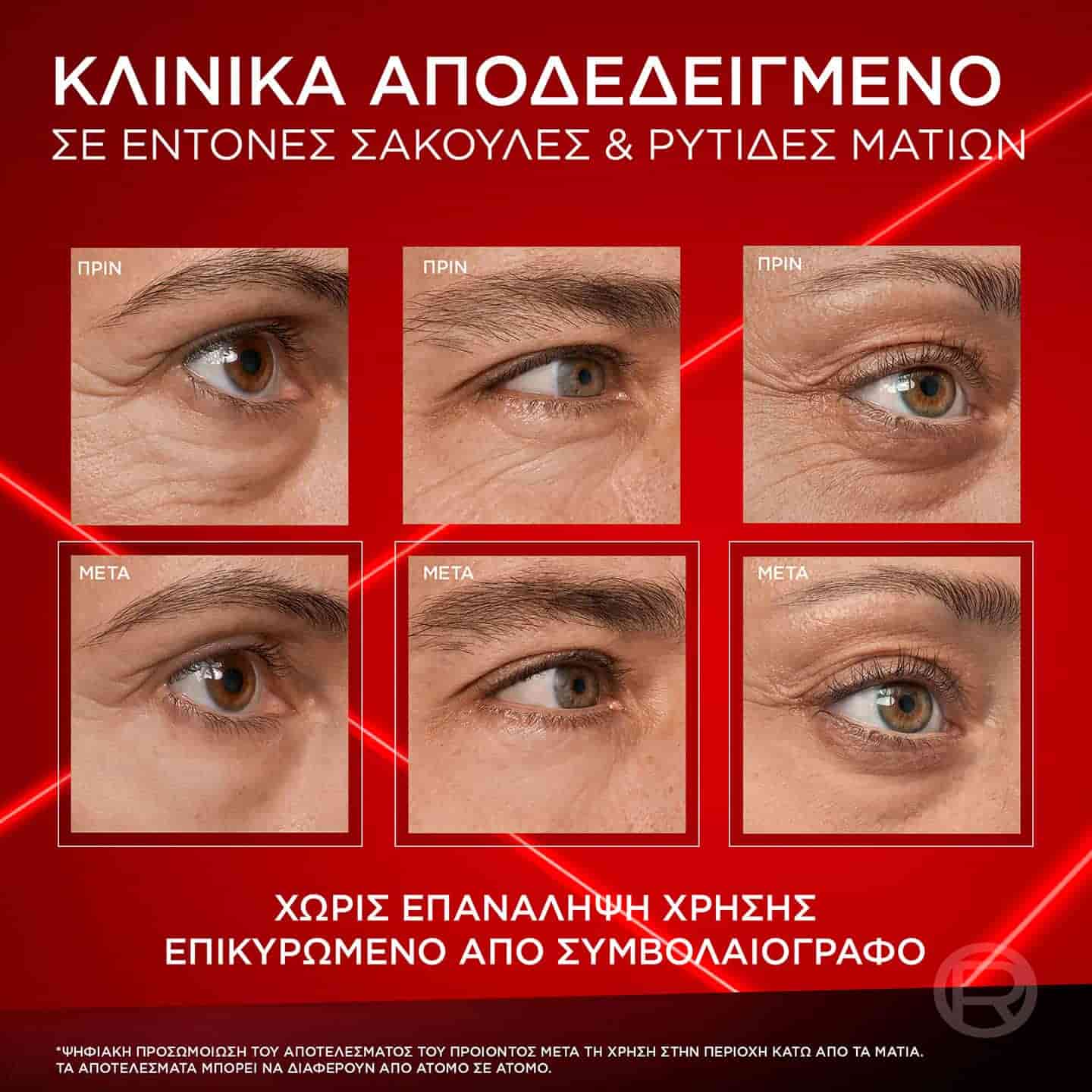 Revitalift Laser Κρέμα Ματιών για Σακούλες Κάτω από τα Μάτια